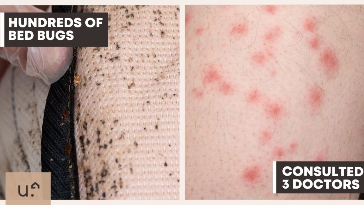 Flea Vs Bed Bug Bites